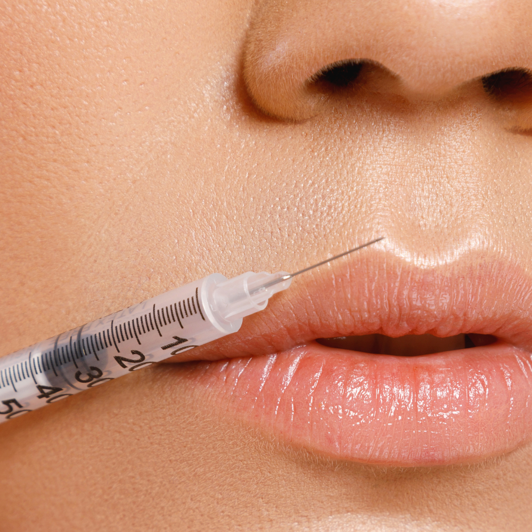 Dermal Fillers & Cosmetic Injections - Sharkra Medi Spa